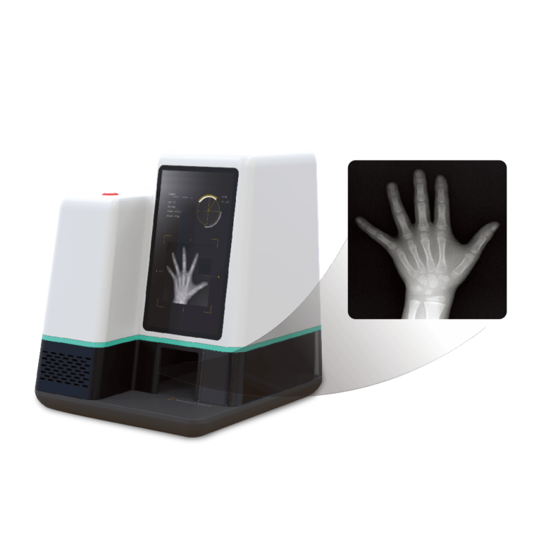 Pediatric Bone Age X Ray System Healthcare Armor