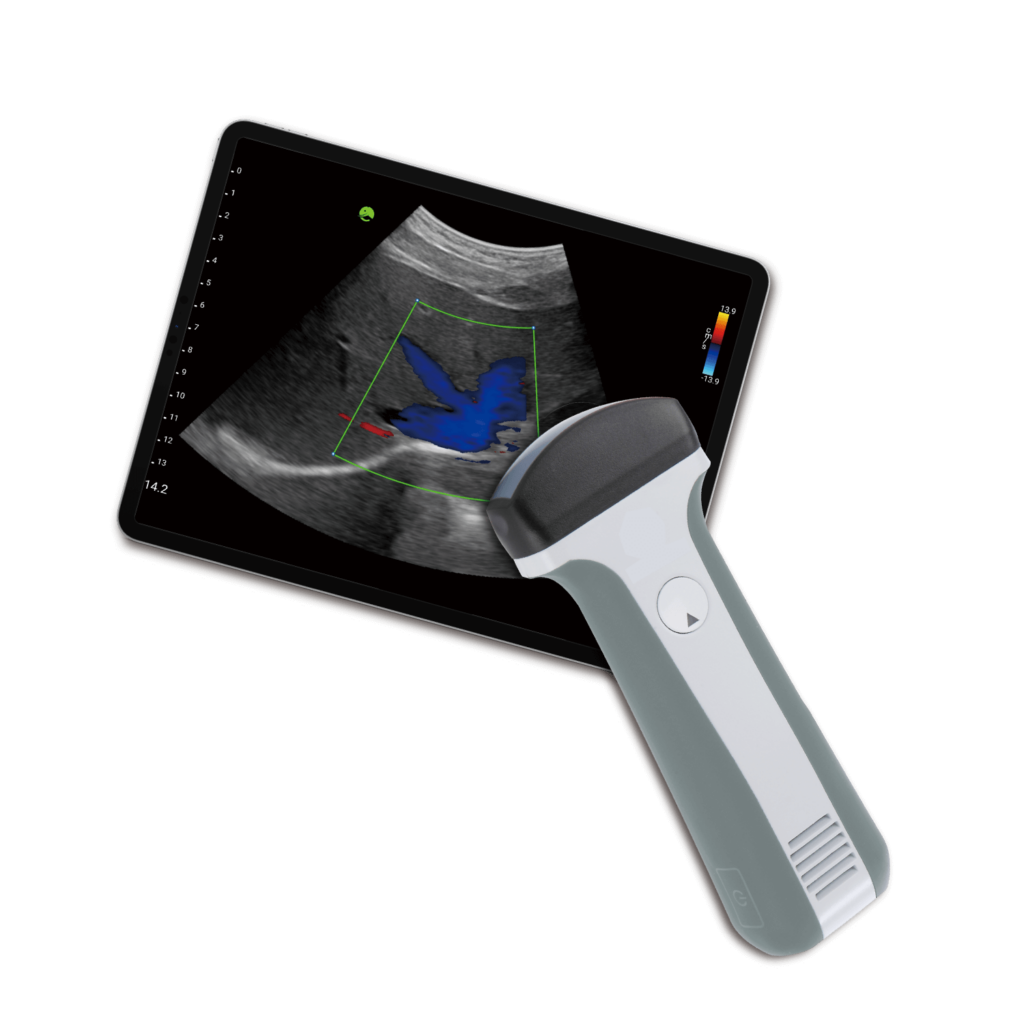 Handheld Ultrasound | Healthcare Armor
